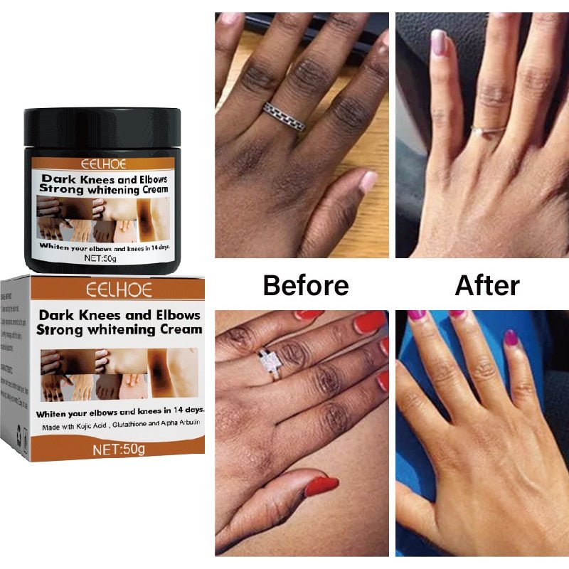 Dark Knuckles Fast Whitening Cream – Linnaco